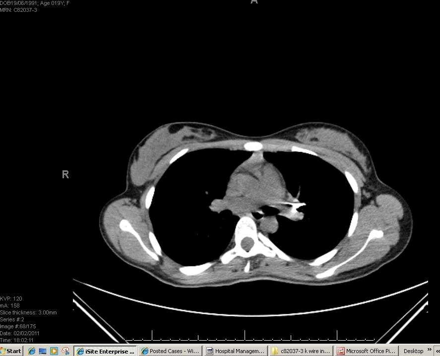 Wound & Hardware Infection - Trauma - Orthobullets