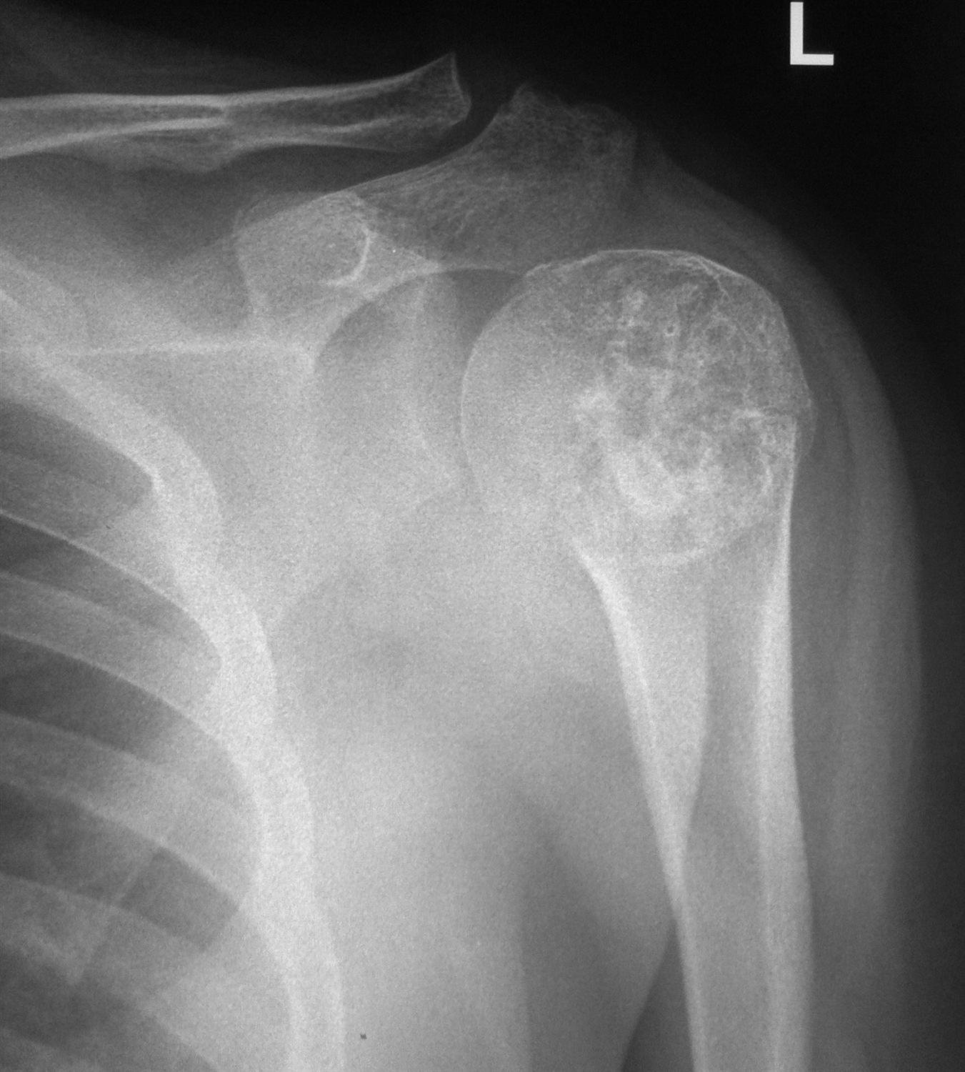 Differential Groups - Pathology - Orthobullets