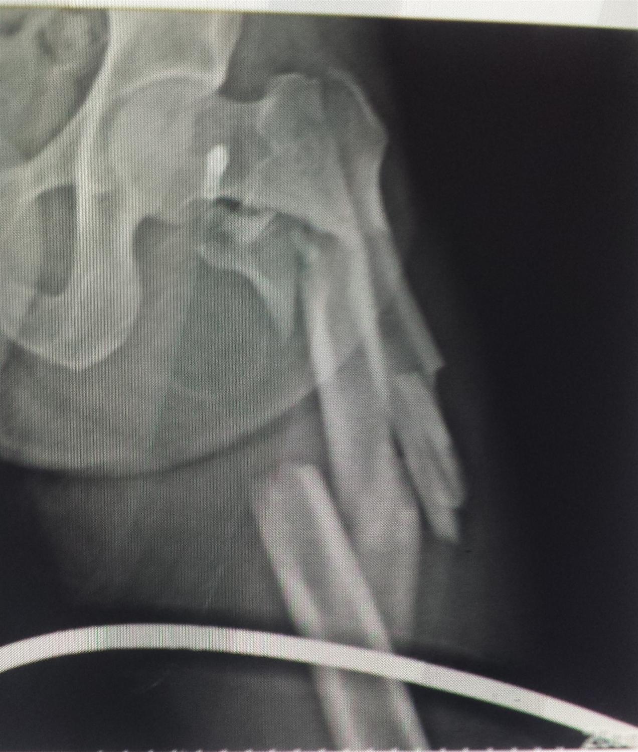 Other Trauma Topics - Trauma - Orthobullets