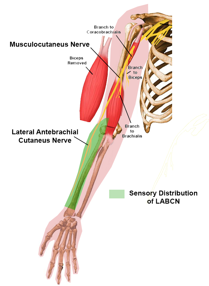 Lateral Antebrachial Cutaneus Nerve Anatomy Medbullets Step 1 Lateral Antebrachial Cutaneus Nerve Anatomy Medbullets Step 1