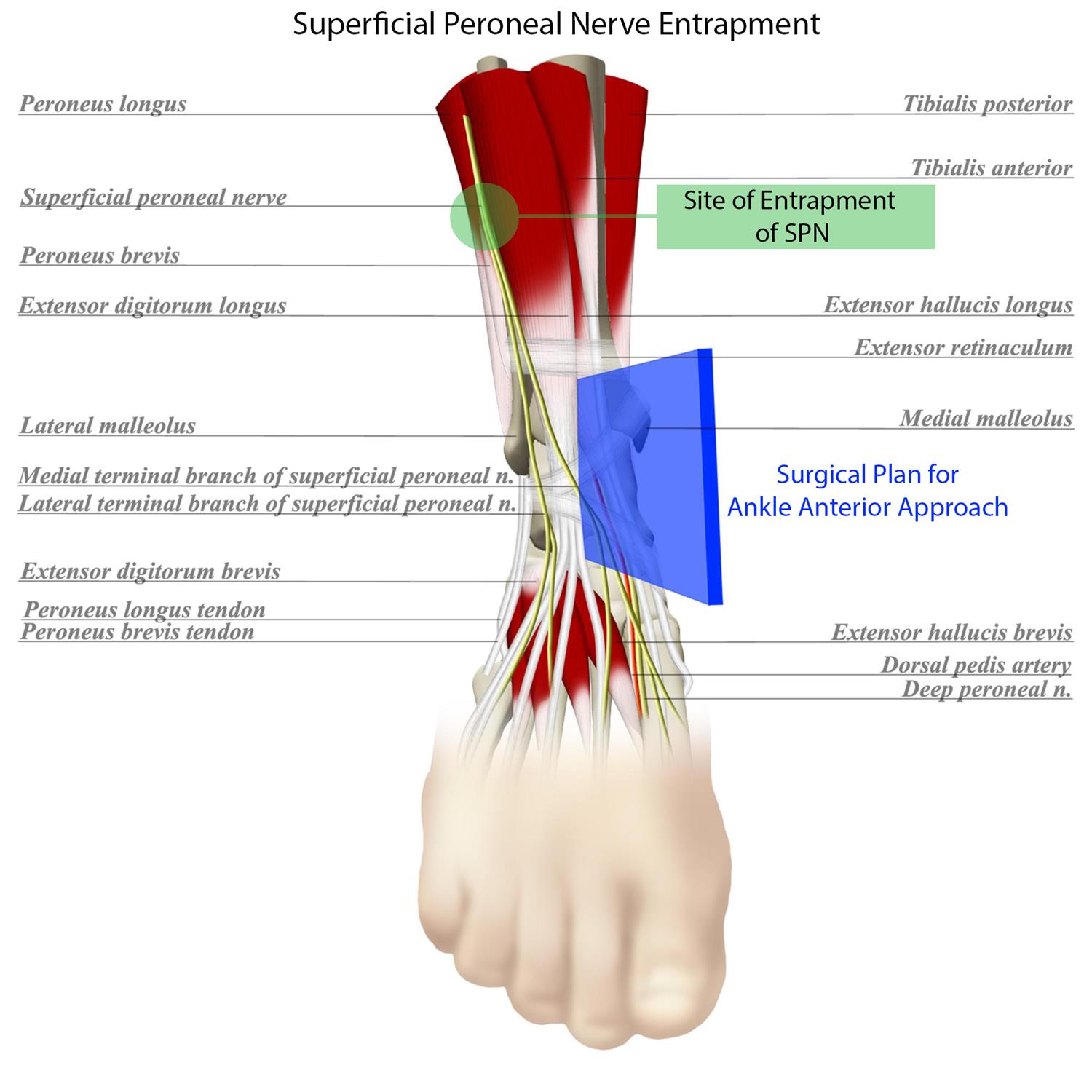 Question 117 - Qbank - Orthobullets