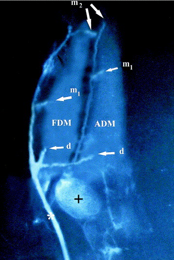 Question 1267 - Qbank - Orthobullets