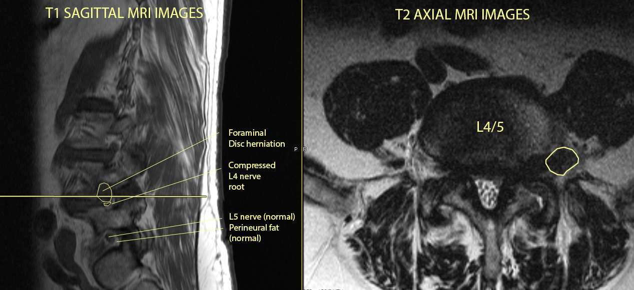 Question 1272 - Qbank - Orthobullets