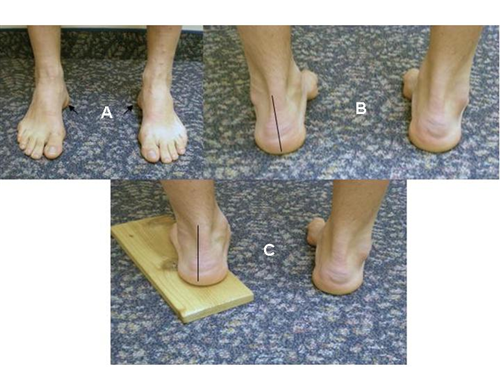 Question 1316 - Qbank - Orthobullets