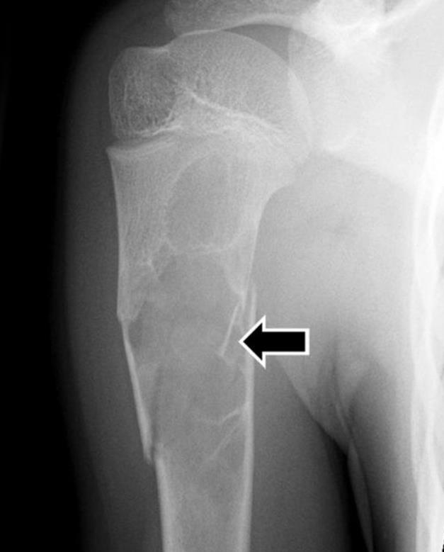 Question 215274 - Qbank - Orthobullets