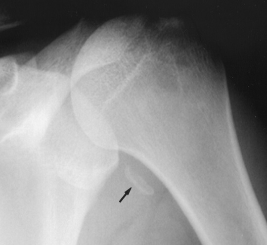 Question 210105 - Qbank - Orthobullets