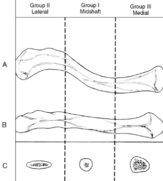 Question 210122 - Qbank - Orthobullets