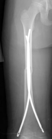 Question 210140 - Qbank - Orthobullets