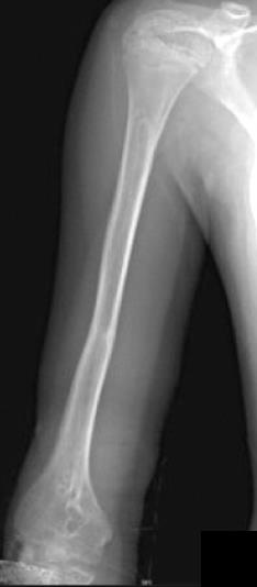 Question 210140 - Qbank - Orthobullets