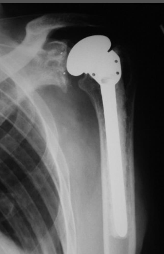 Question 210145 - Qbank - Orthobullets