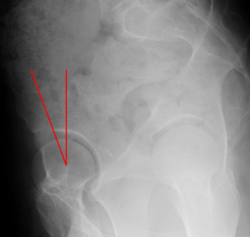 Question 214264 - Qbank - Orthobullets