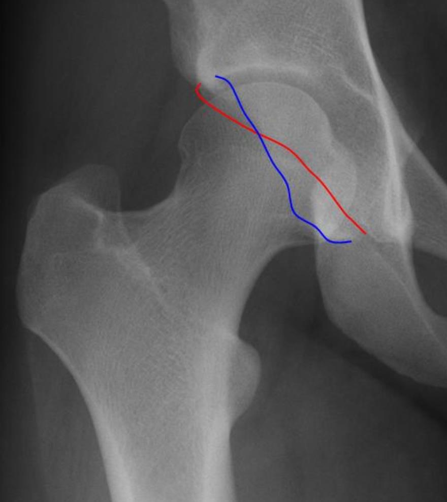 Question 214264 - Qbank - Orthobullets