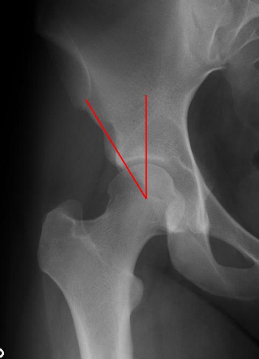 Question 214264 - Qbank - Orthobullets