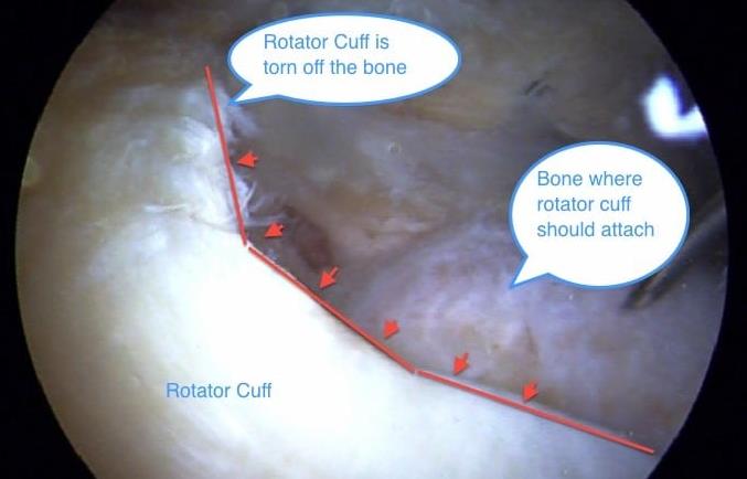 Question 210167 - Qbank - Orthobullets