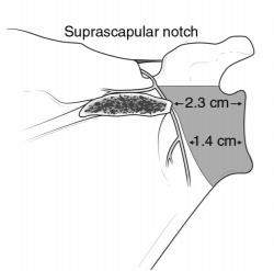 Question 210195 - Qbank - Orthobullets