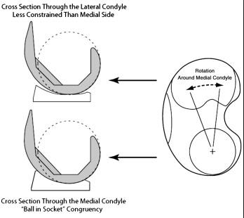 Question 210274 - Qbank - Orthobullets