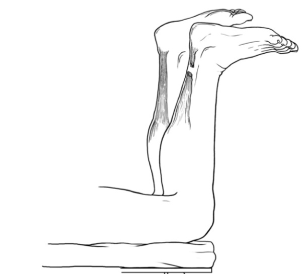 Question 210279 - Qbank - Orthobullets