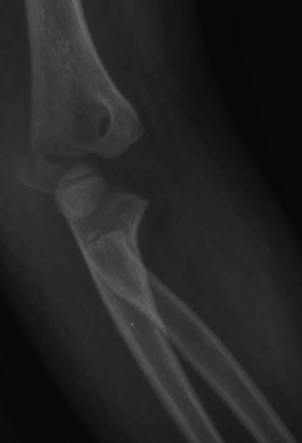 Question 210709 - Qbank - Orthobullets