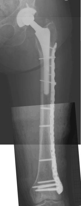 Question 210934 - Qbank - Orthobullets