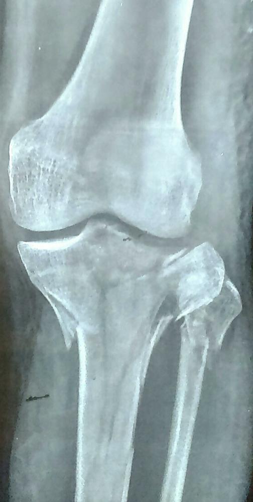 Articular Cartilage - Basic Science - Orthobullets