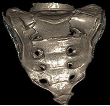 Question 211135 - Qbank - Orthobullets