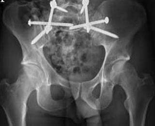 Question 211135 - Qbank - Orthobullets