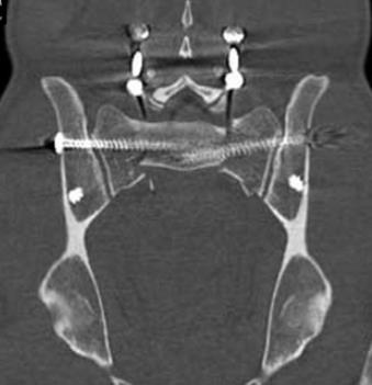 Question 211135 - Qbank - Orthobullets