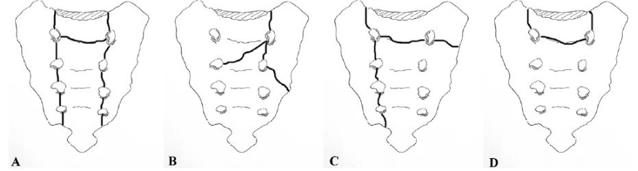 Question 211135 - Qbank - Orthobullets