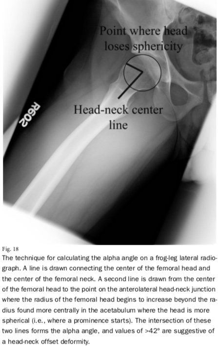 Question 211185 - Qbank - Orthobullets