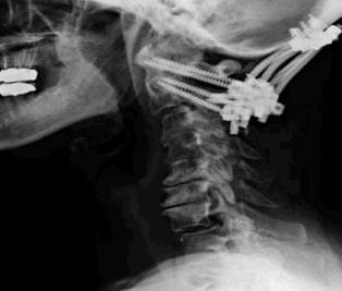 Question 211212 - Qbank - Orthobullets