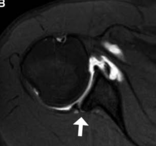 Question 211216 - Qbank - Orthobullets