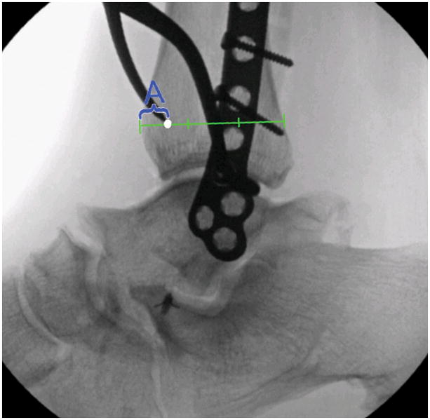 Question 211242 - Qbank - Orthobullets