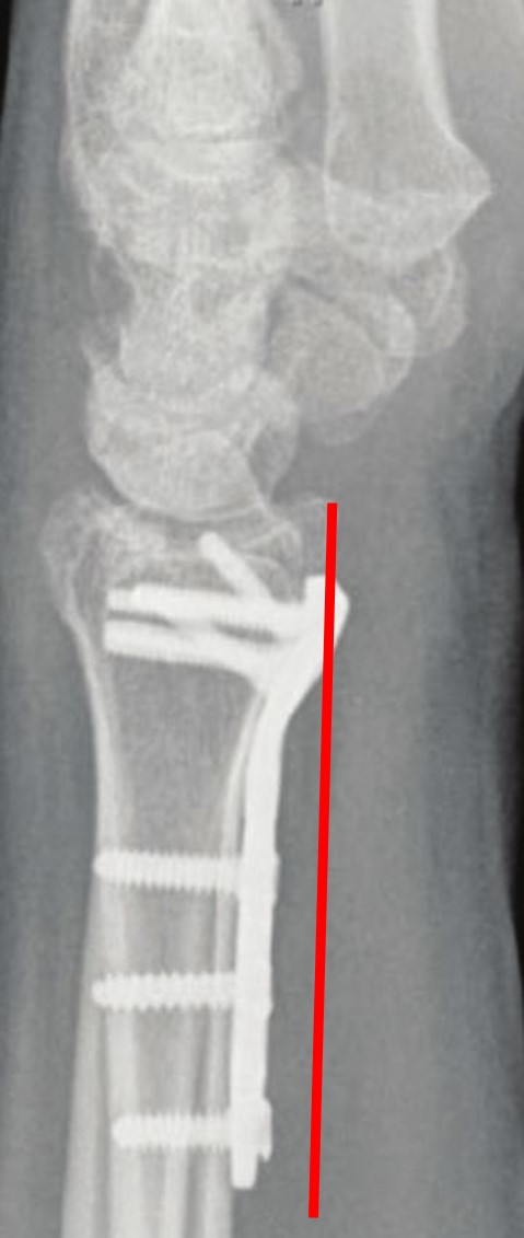 Question 211248 - Qbank - Orthobullets
