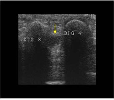 Question 211264 - Qbank - Orthobullets