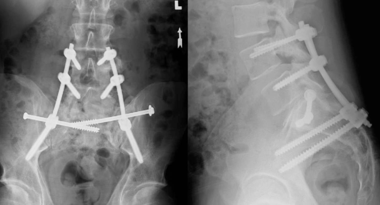 Question 211377 - Qbank - Orthobullets