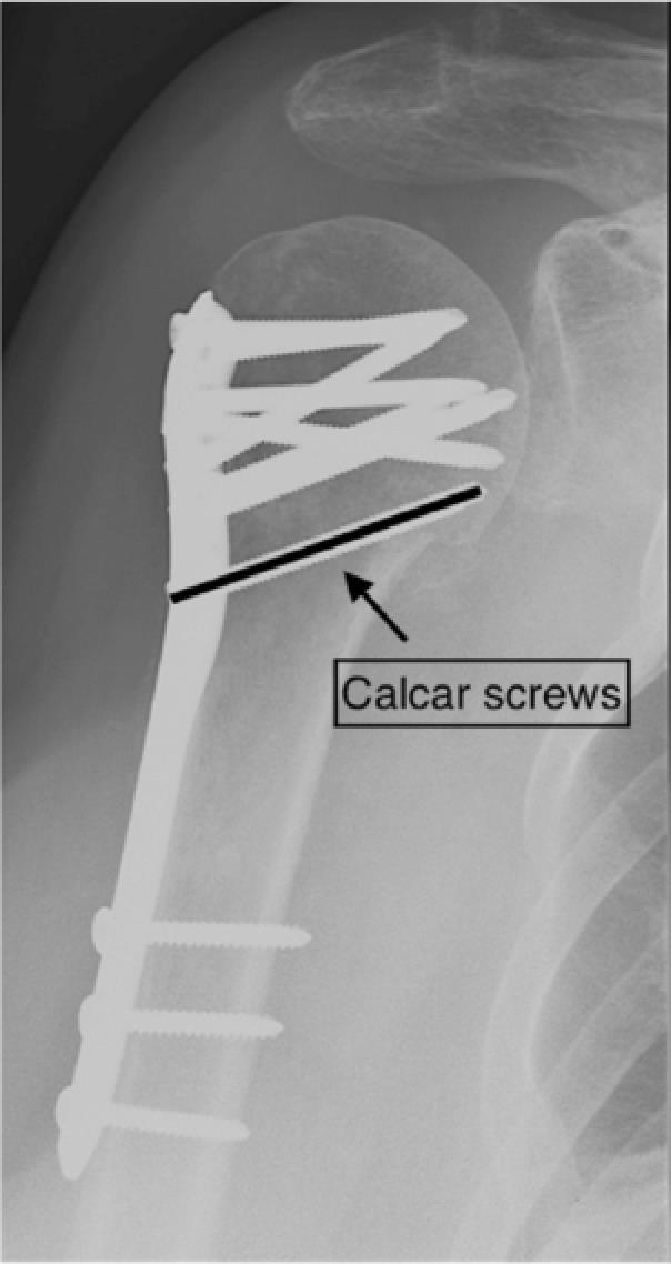 Question 211430 - Qbank - Orthobullets