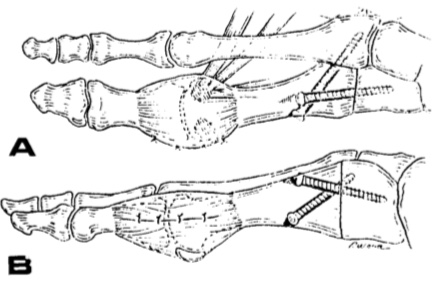 Question 211484 - Qbank - Orthobullets