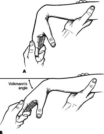 Question 211611 - Qbank - Orthobullets