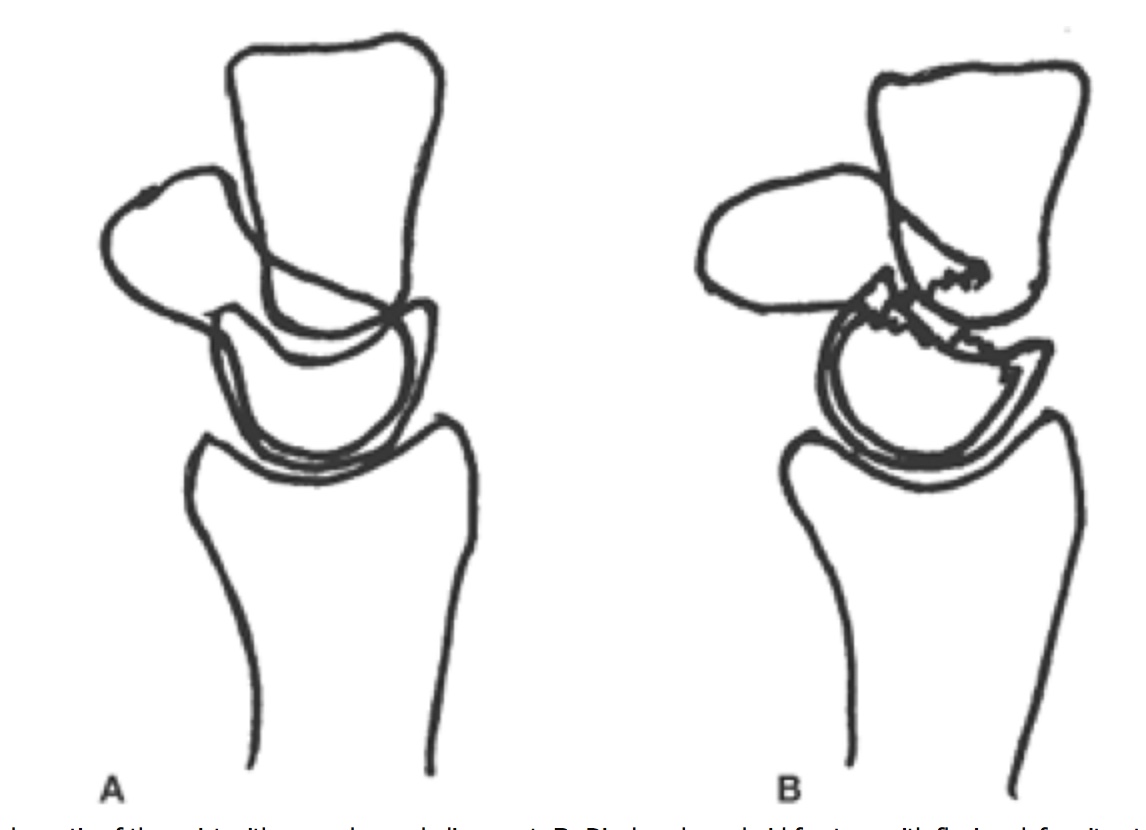 Question 211952 - Qbank - Orthobullets