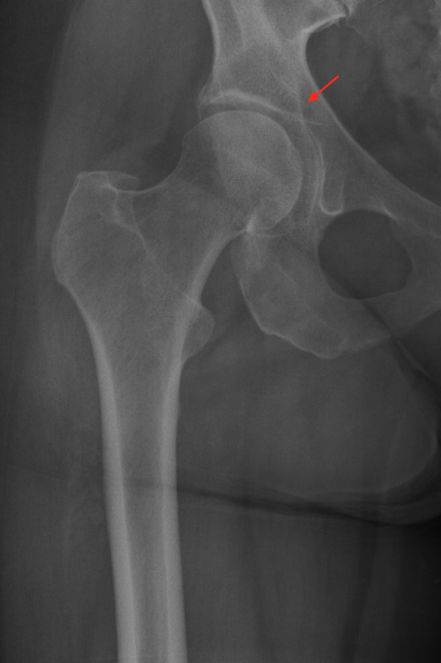 Question 211964 - Qbank - Orthobullets