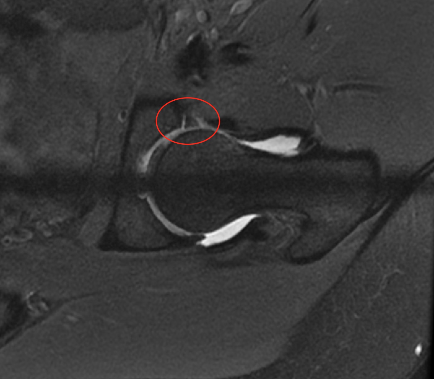 Question 212008 - Qbank - Orthobullets