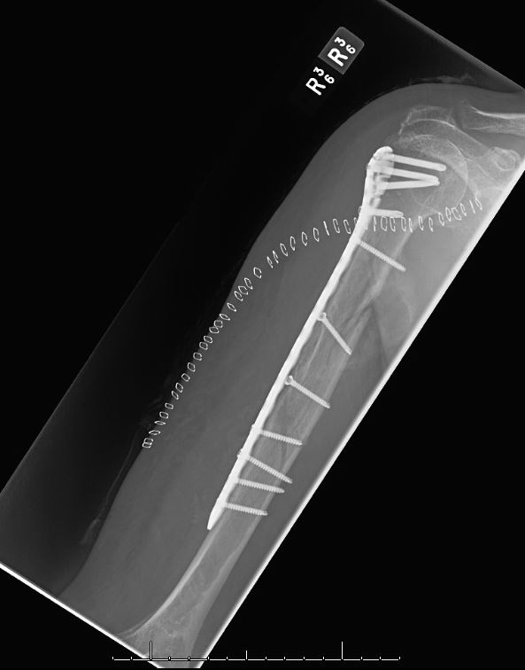 Question 212627 - Qbank - Orthobullets