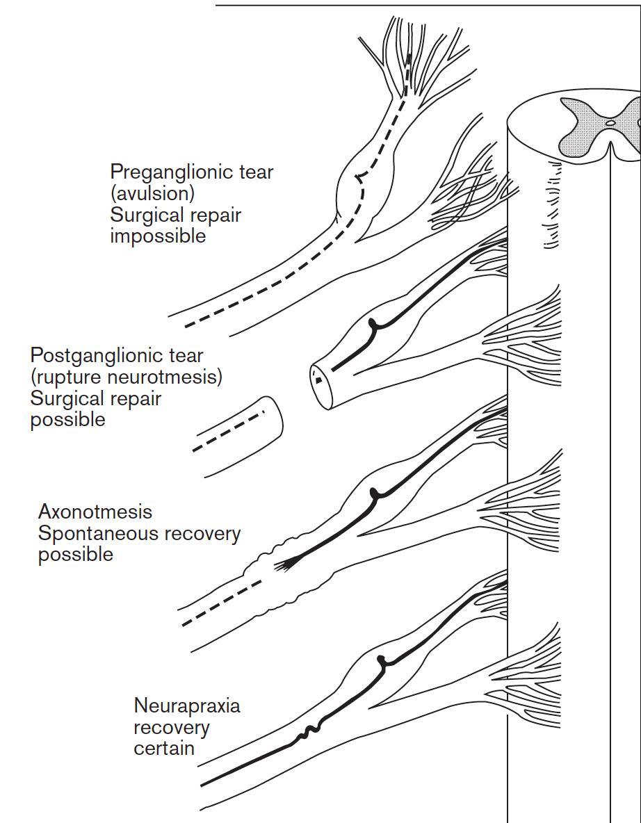 Question 212897 - Qbank - Orthobullets