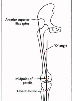 Question 212913 - Qbank - Orthobullets