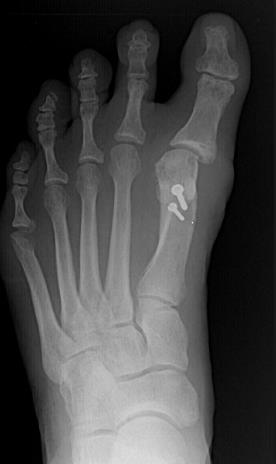 Question 212917 - Qbank - Orthobullets