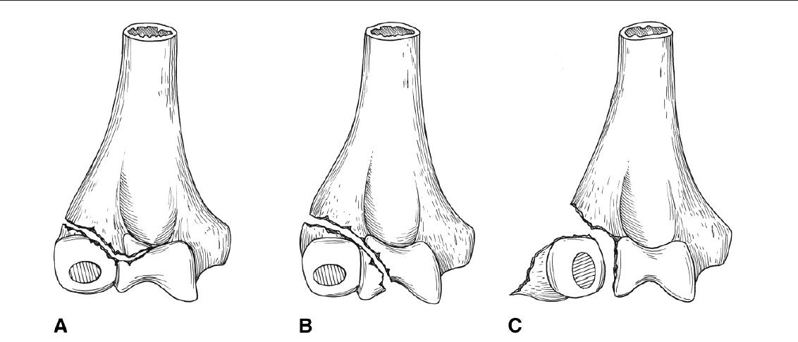 Question 212949 - Qbank - Orthobullets