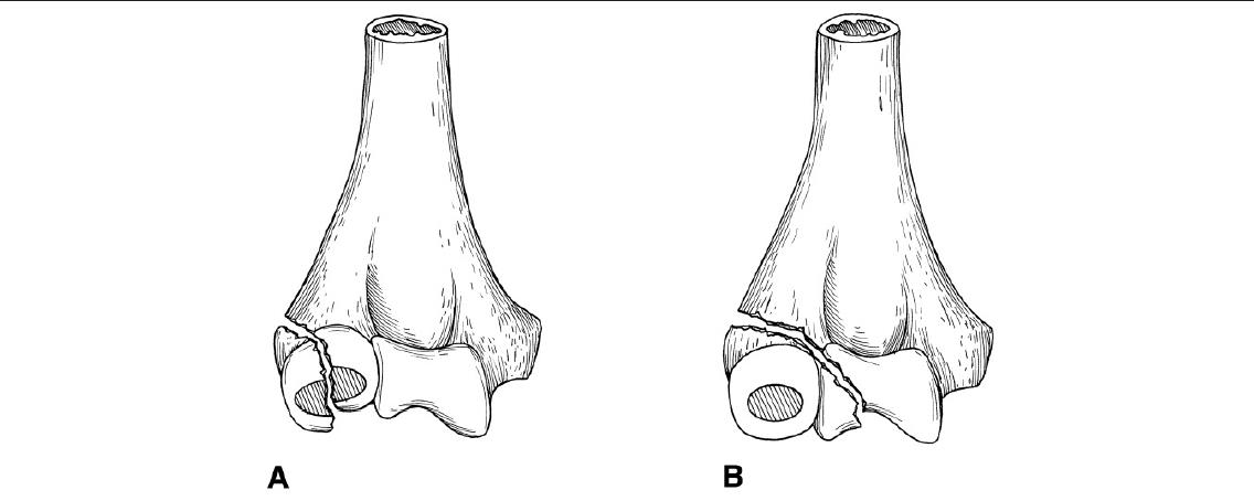 Question 212949 - Qbank - Orthobullets