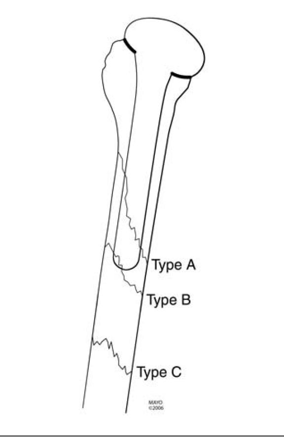 Question 212959 - Qbank - Orthobullets