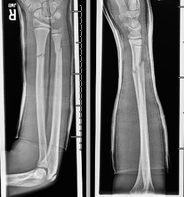 Question 212963 - Qbank - Orthobullets