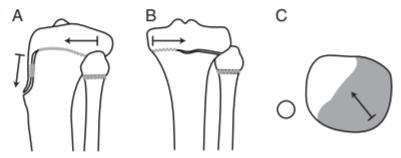 Question 212969 - Qbank - Orthobullets